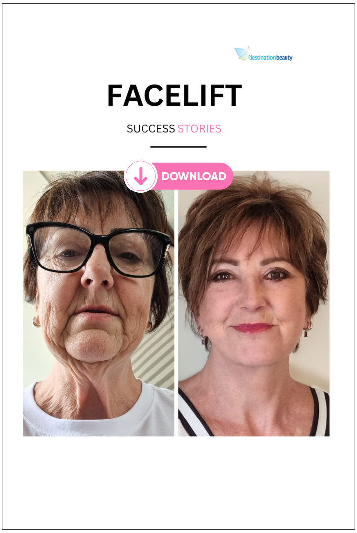 Facelift Success Stories - Destination Beauty